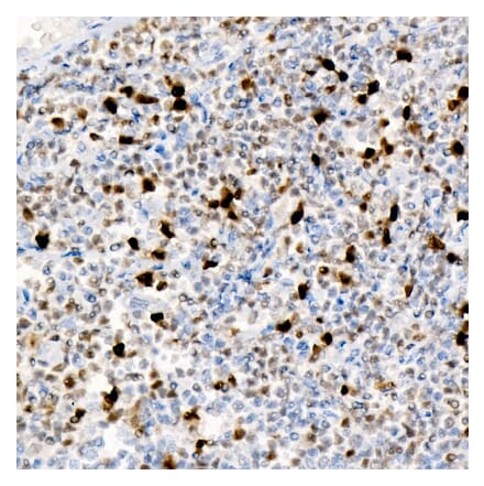 MUM1 Antibodies | Antibodies.com