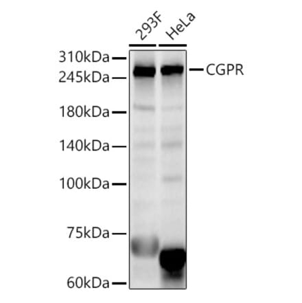 CGRP Antibodies | Antibodies.com