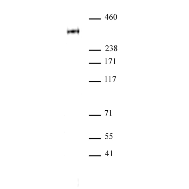 Anti-RNA polymerase II CTD (phospho Thr4) Antibody (A320172)