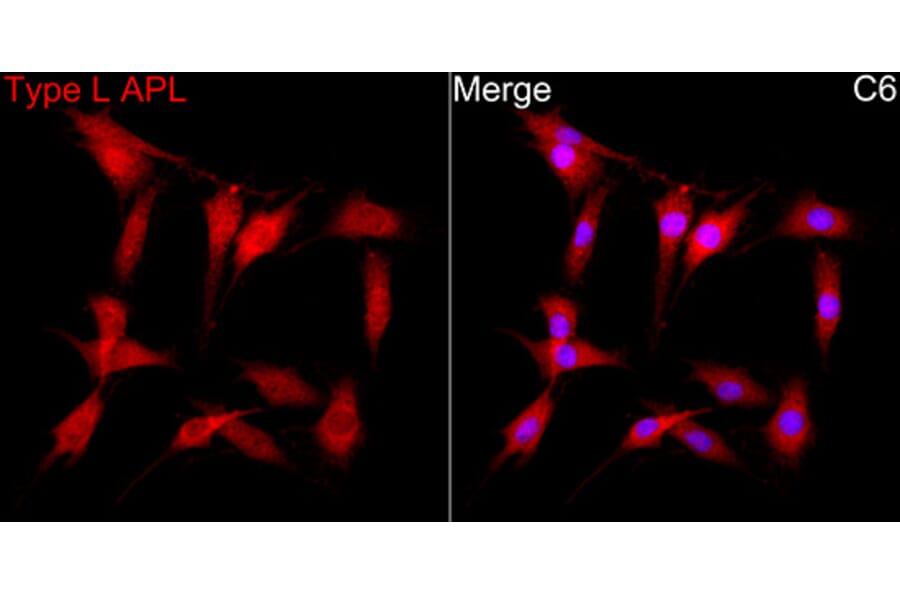 Anti-PML + RARA Antibody (A329759) | Antibodies.com