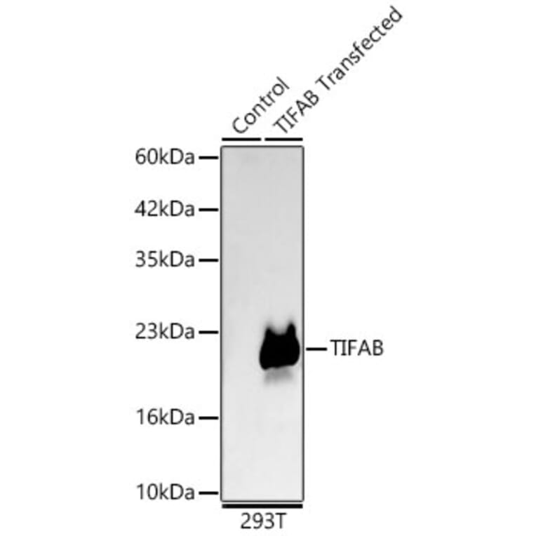 Anti-TIFAB Antibody [ARC62261] (A329891) | Antibodies.com