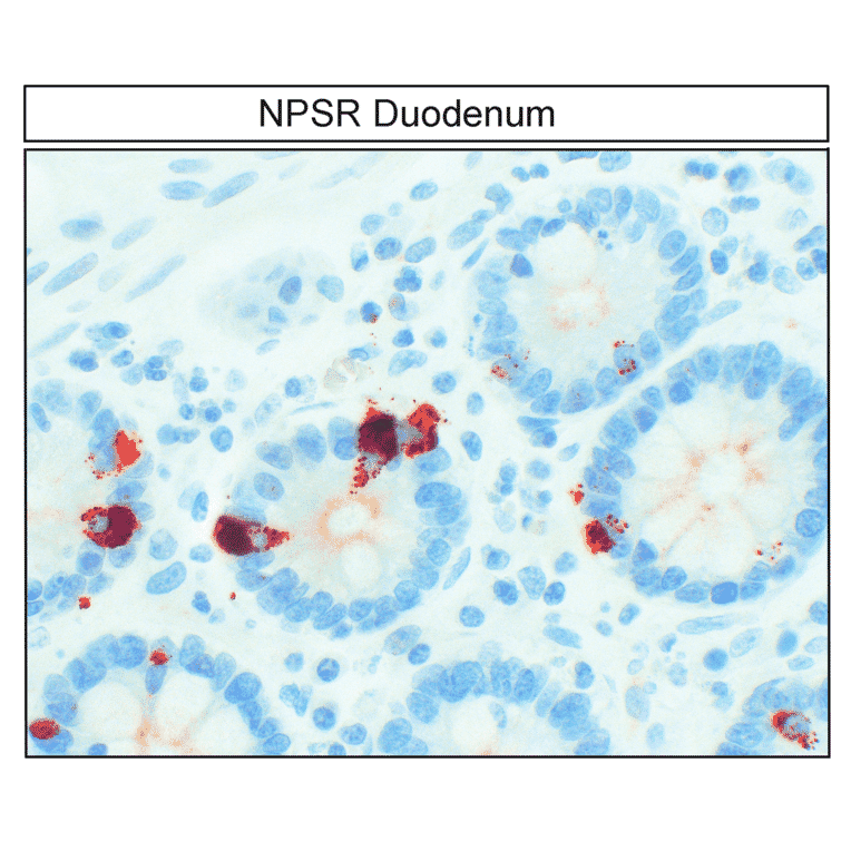 Anti-NPSR Antibody (A334514) | Antibodies.com