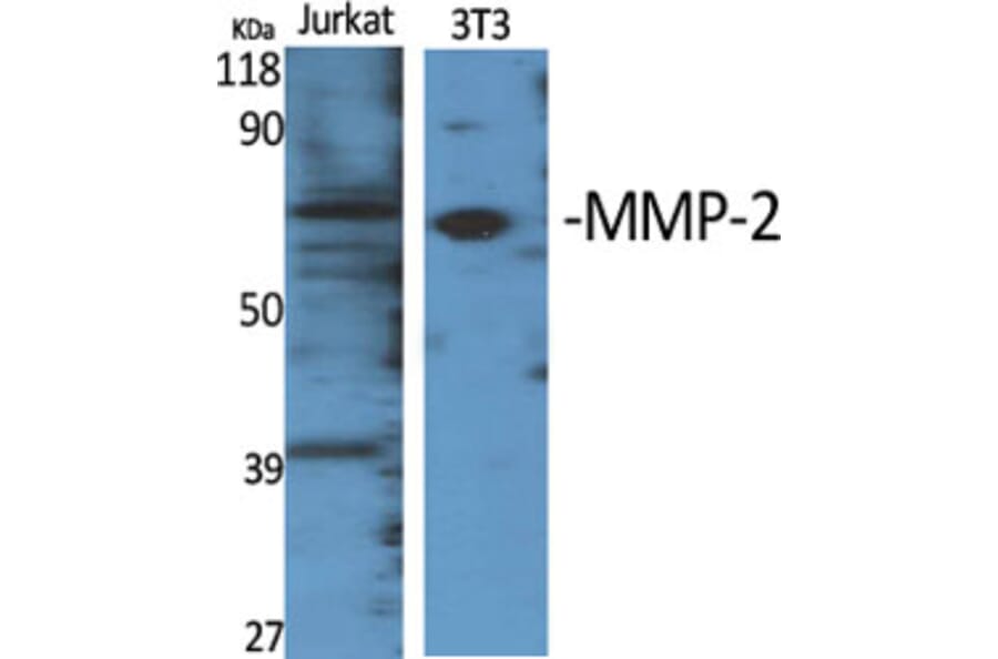 Anti-MMP-2 Antibody (A34449) | Antibodies.com