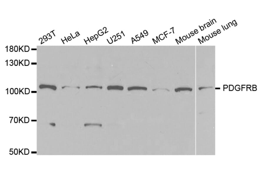 Anti-PDGFRB Antibody (A34978) | Antibodies.com