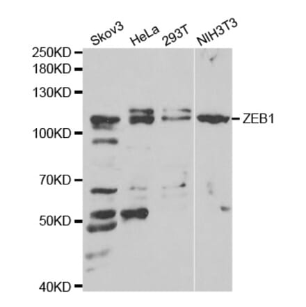 ZEB1 Antibodies | Antibodies.com