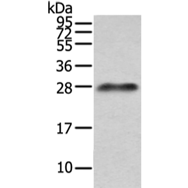 Anti Lambda Light Chain Antibody A36261