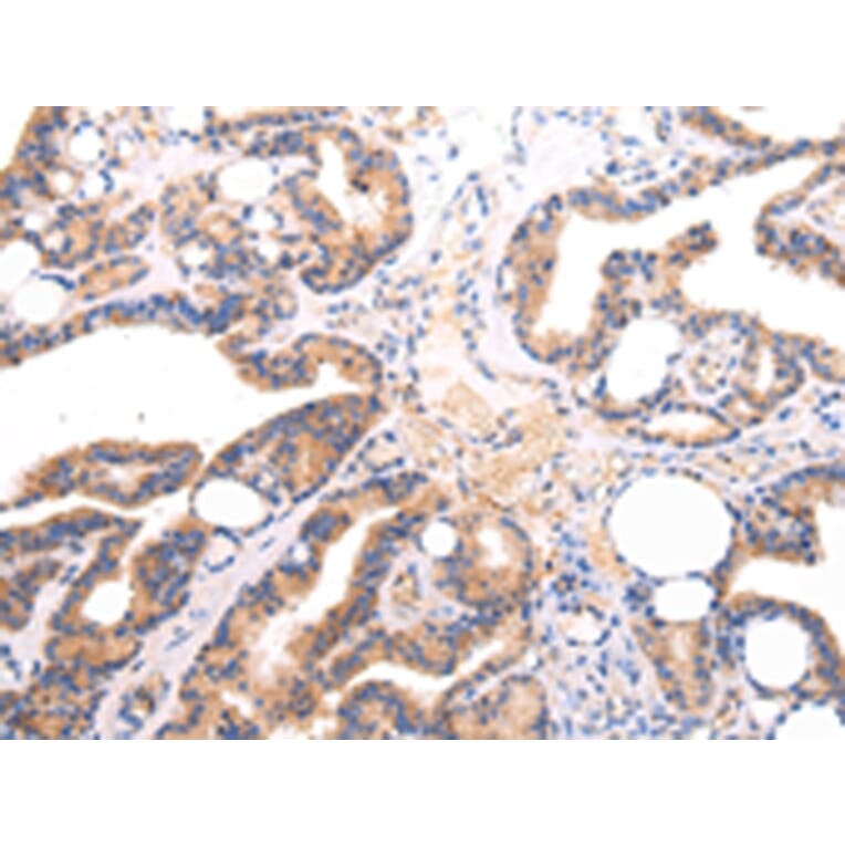 Anti Lambda Light Chain Antibody A36261