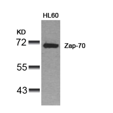 ZAP70 Antibodies | Antibodies.com