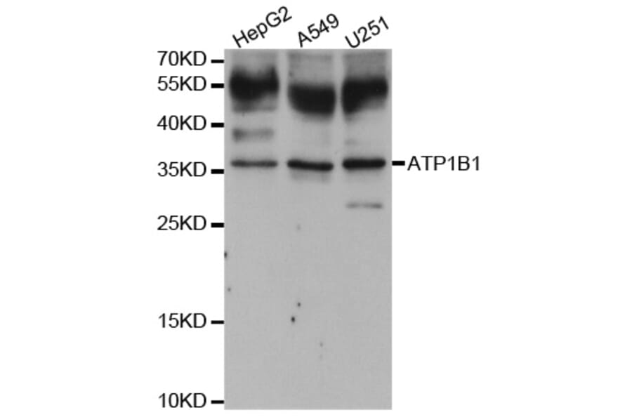 Anti-ATP1B1 Antibody (A37072) | Antibodies.com