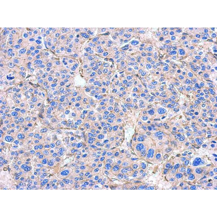 Anti-Alpha Smooth Muscle Actin Antibody (A38313) | Antibodies.com