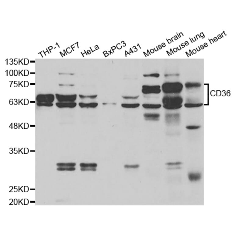 Anti-CD36 Antibody (A38574) | Antibodies.com