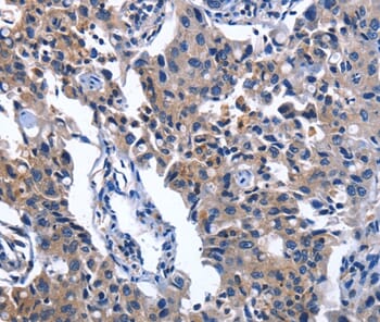 Anti-NAT8 Antibody (A38709) | Antibodies.com Anti-NAT8 Antibody (A38709) | Antibodies.com
