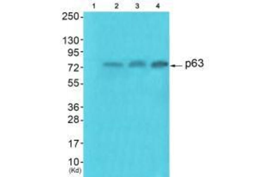 Anti-p63 Antibody (A40117) | Antibodies.com