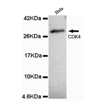Cdk4 Antibodies | Antibodies.com