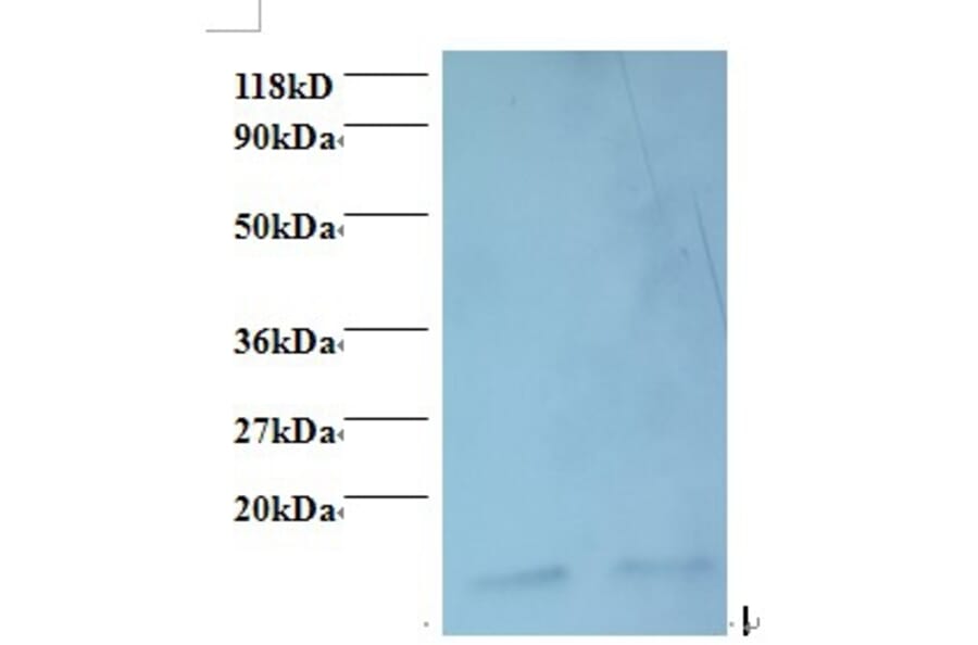 Anti Macrophage Migration Inhibitory Factor Antibody A41017