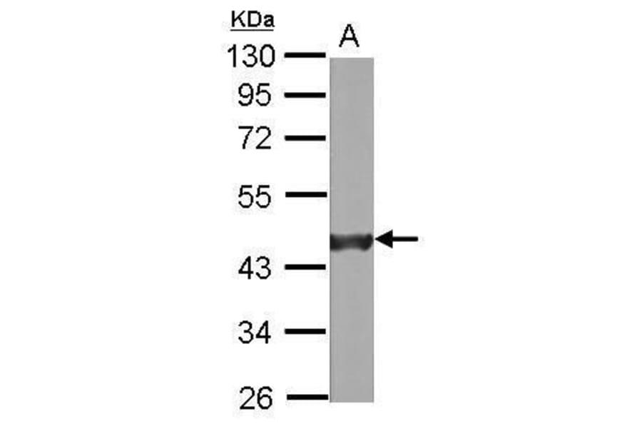 Anti-alpha smooth muscle Actin Antibody (A43525) | Antibodies.com
