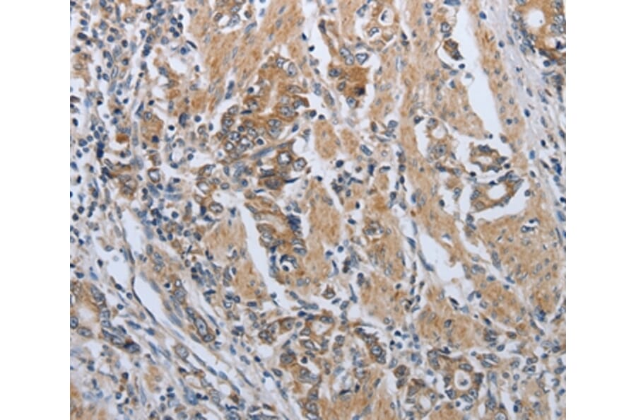 Anti-PDCD1 Antibody (A46148) | Antibodies.com