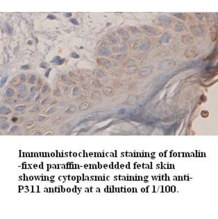 P311 Antibodies | Antibodies.com