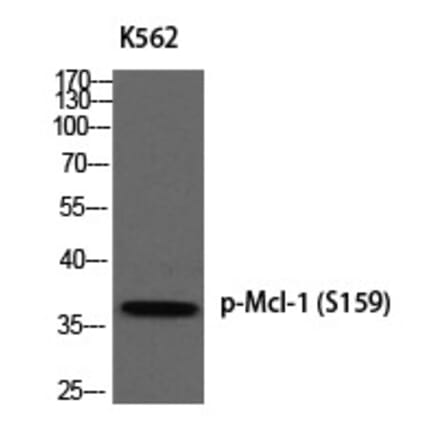 MCL1 Antibodies | Antibodies.com