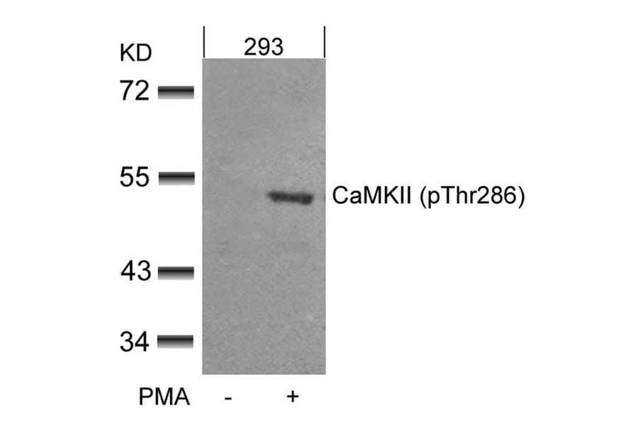 Anti-CaMKII (Phospho-Thr286) Antibody (A50881) | Antibodies.com