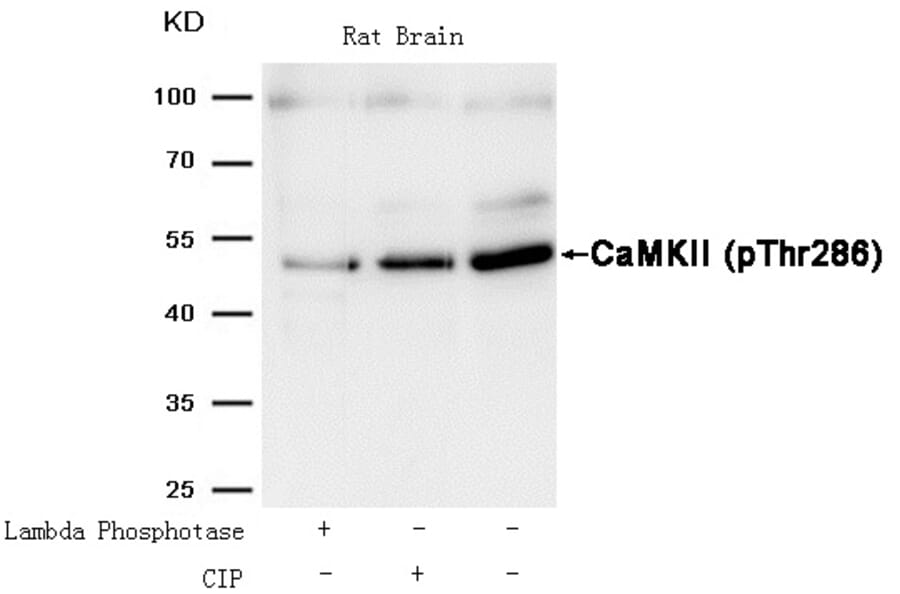 Anti-CaMKII (Phospho-Thr286) Antibody (A50881) | Antibodies.com