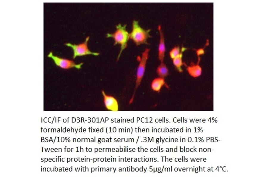 Anti-Dopamine Receptor D3 Antibody (A52517) | Antibodies.com Anti-Dopamine Receptor D3 Antibody (A52517) | Antibodies.com