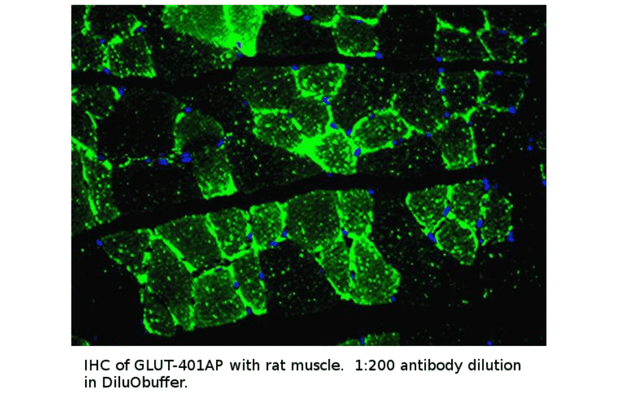 Anti-Glucose Transporter GLUT 4 Antibody (A53621) | Antibodies.com Anti-Glucose Transporter GLUT 4 Antibody (A53621) | Antibodies.com
