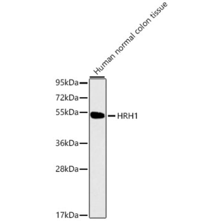 Anti-HRH1/H1R Antibody (A80554) | Antibodies.com