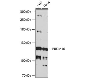 Anti-PRDM16 Antibody (A285929) | Antibodies.com