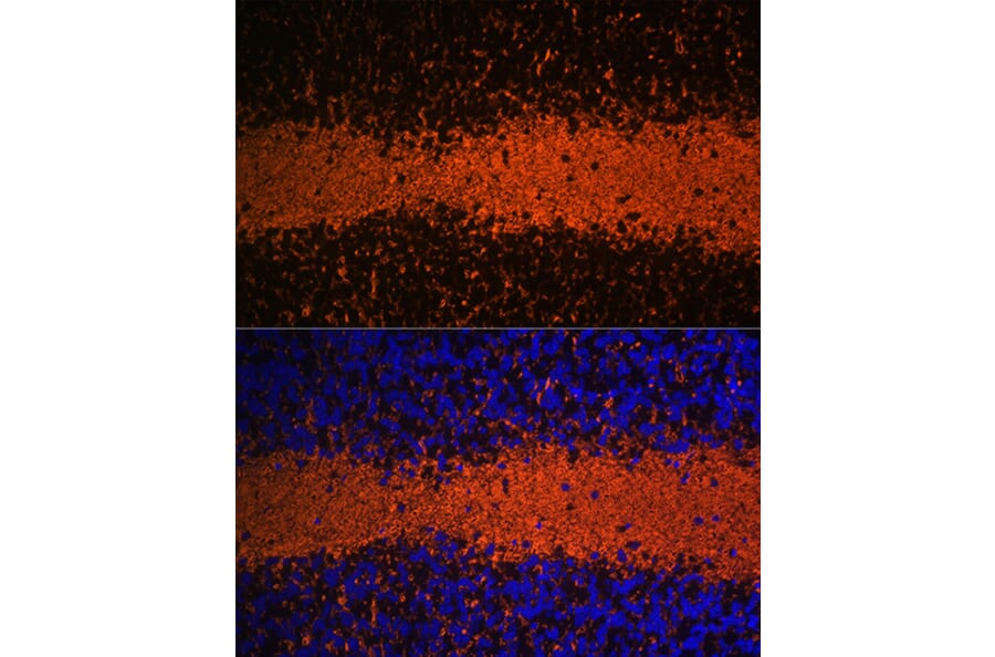 Anti Myelin Basic Protein Antibody Arc0535 A80785