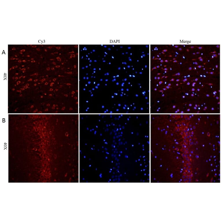 Anti-BDNF Antibody (A83462) | Antibodies.com