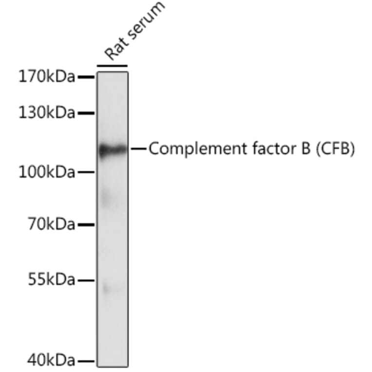 Anti-Complement factor B Antibody (A87723) | Antibodies.com