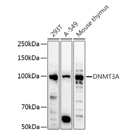 Dnmt3a Antibodies | Antibodies.com