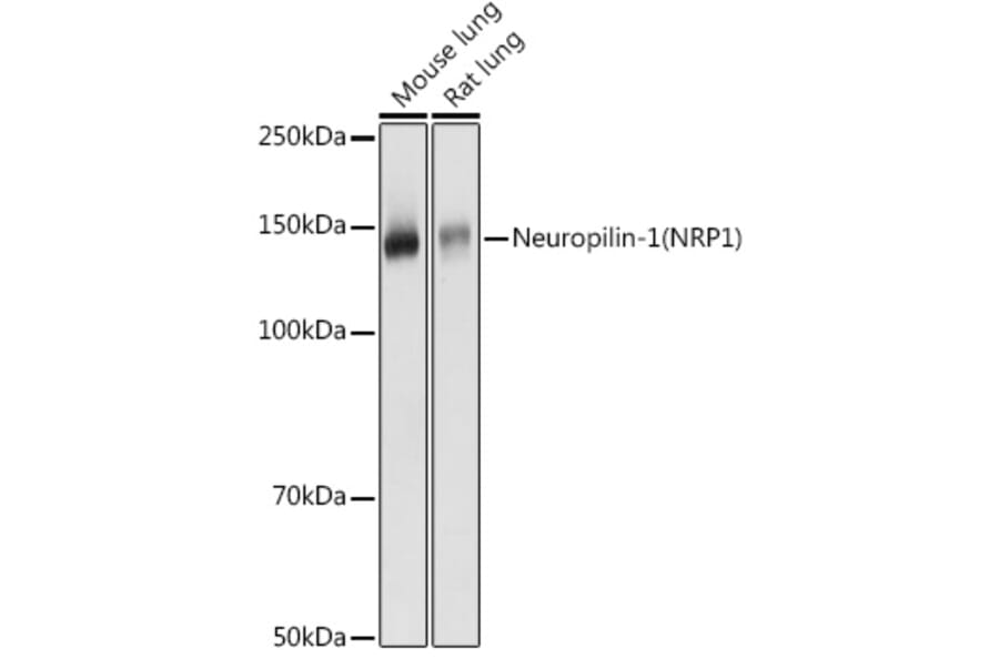 Anti-Neuropilin 1 Antibody (A87754) | Antibodies.com