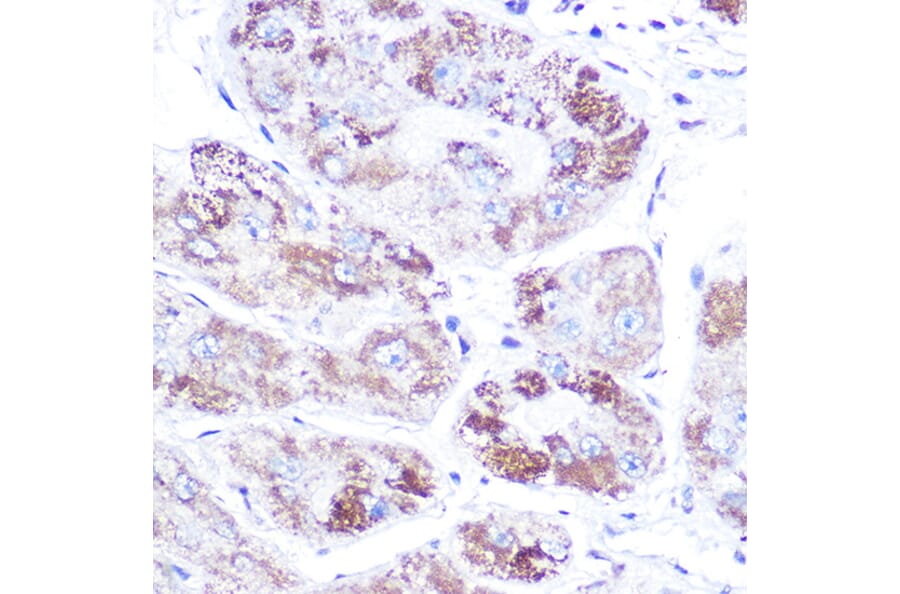 Anti Mineralocorticoid Receptor Antibody A87802