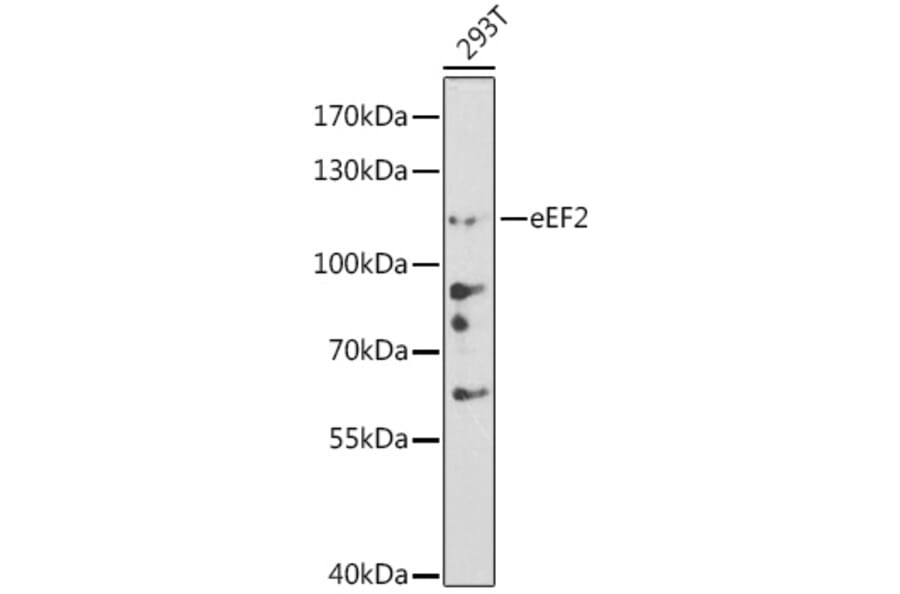 Anti-EEF2/Elongation factor 2 Antibody (A87857) | Antibodies.com