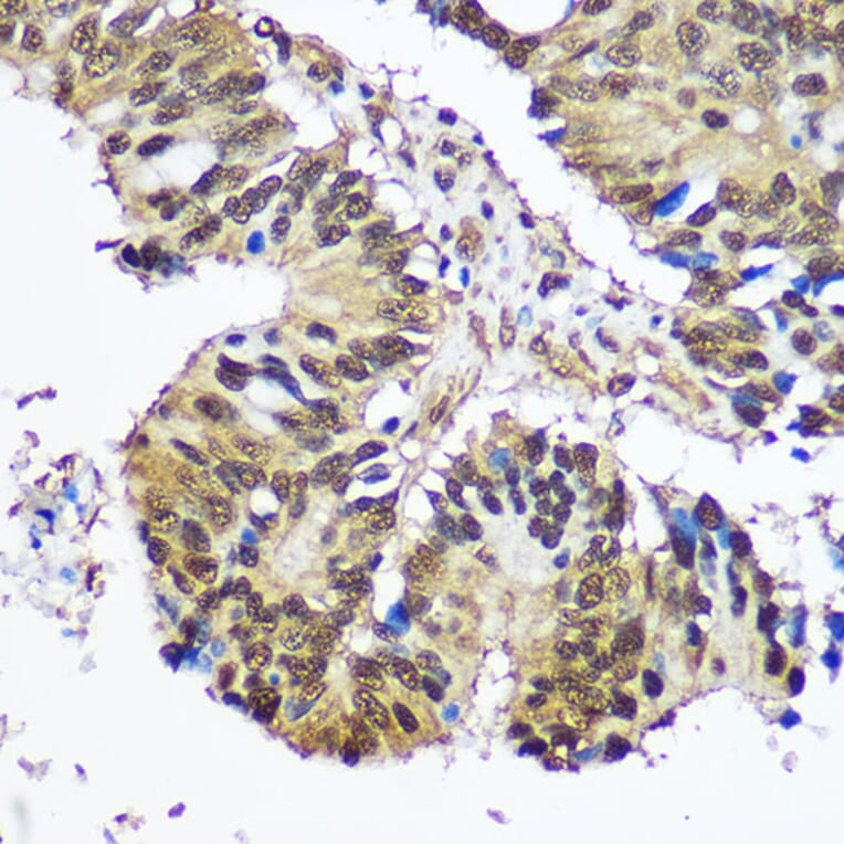 Anti E1 Ubiquitin Activating Enzyme 1 Uba1 Anticorps A88062