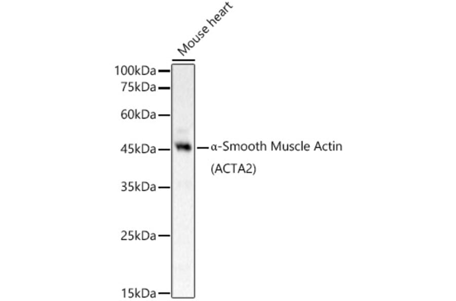 Anti-alpha smooth muscle Actin Antibody (A89813) | Antibodies.com