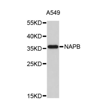 MSF Antibodies | Antibodies.com