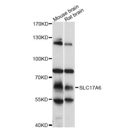 VGLUT2 Antibodies | Antibodies.com