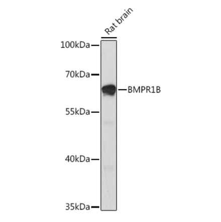 BMPR1B Antibodies | Antibodies.com
