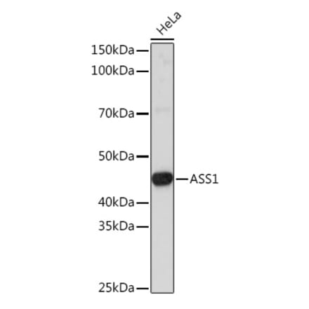 ASS1 Antibodies | Antibodies.com