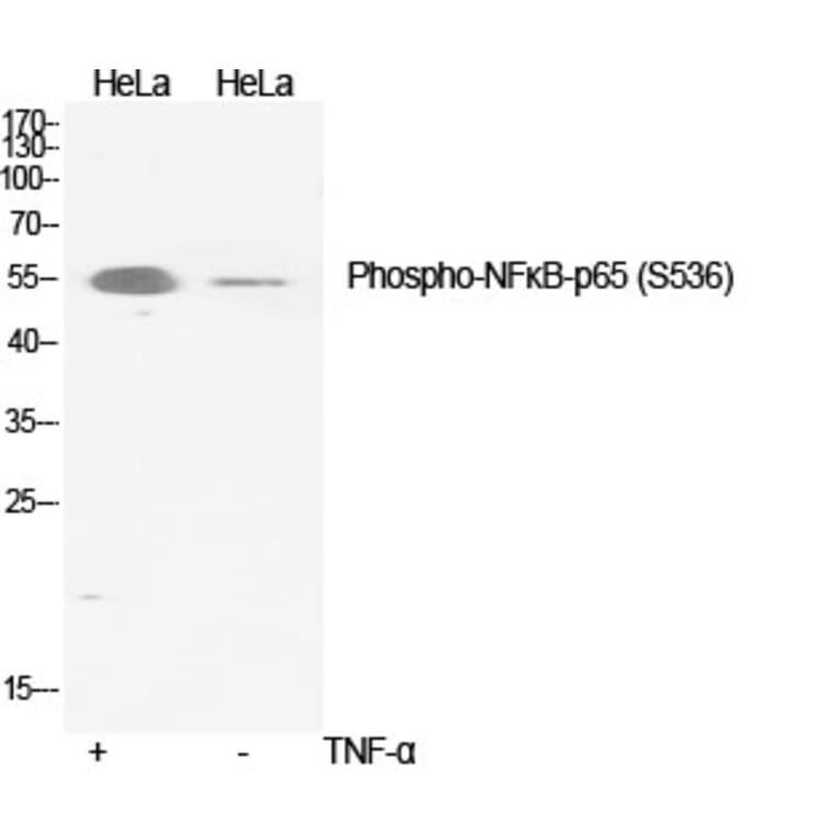 Anti-NF-kappaB p65 (phospho Ser536) Antibody (A93734) | Antibodies.com
