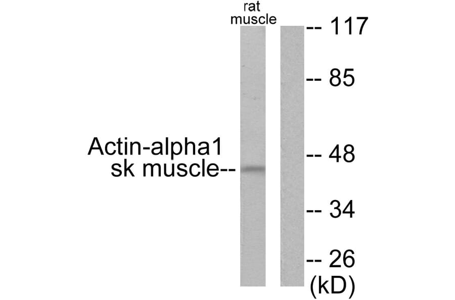 Anti-Actin-alpha-1 Antibody (A94768) | Antibodies.com