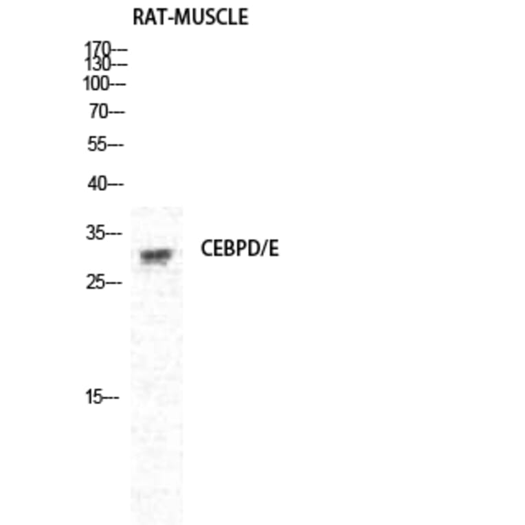 Anti-CEBPD + CEBPE Antibody (A95299) | Antibodies.com