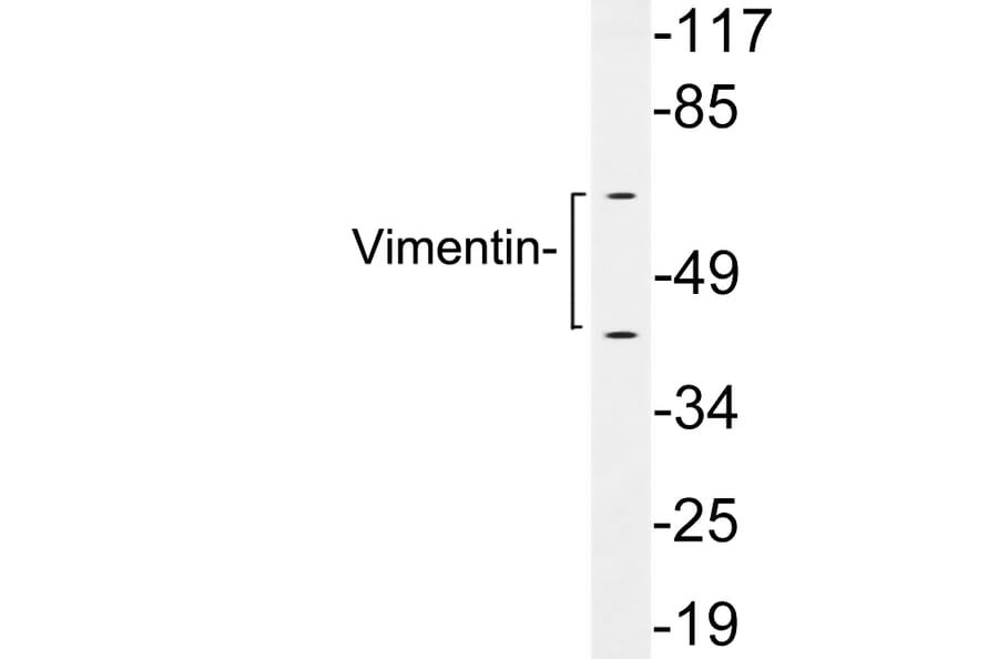 Anti-Vimentin Antibody (A96304) | Antibodies.com