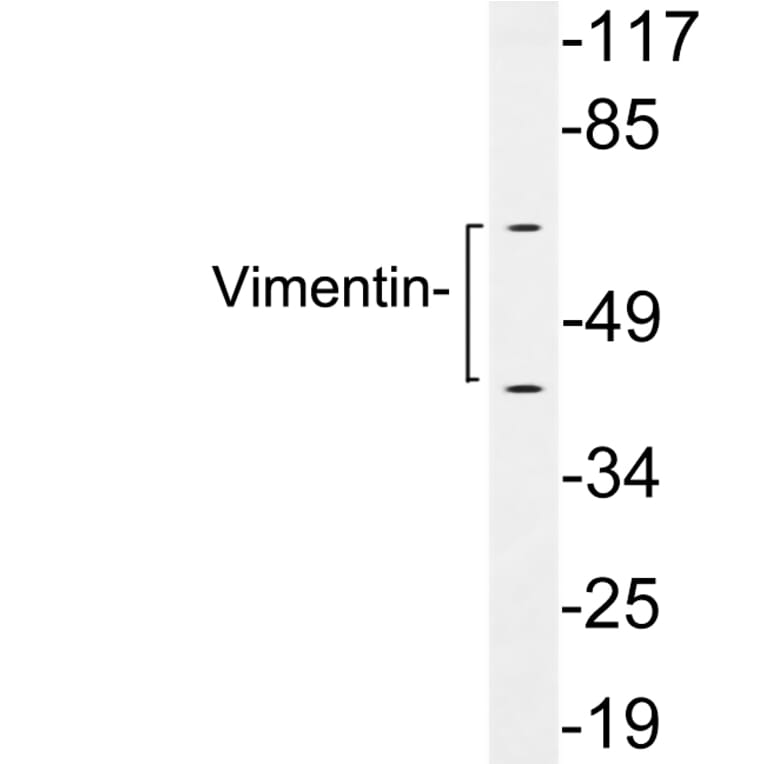 Anti-Vimentin Antibody (A96304) | Antibodies.com