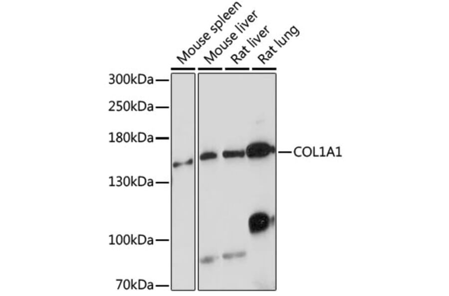 Anti-COL1A1 Antibody (A88196) | Antibodies.com