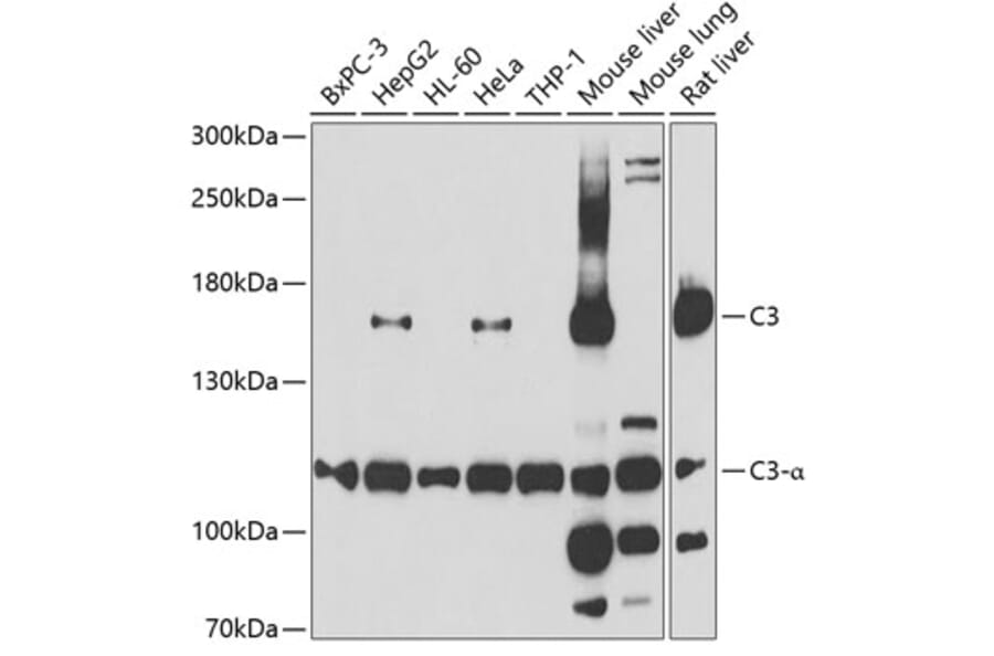 Anti-C3a Antibody (A15408) | Antibodies.com
