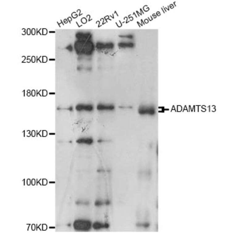 Anti-ADAMTS13 Antibody (A10432) | Antibodies.com